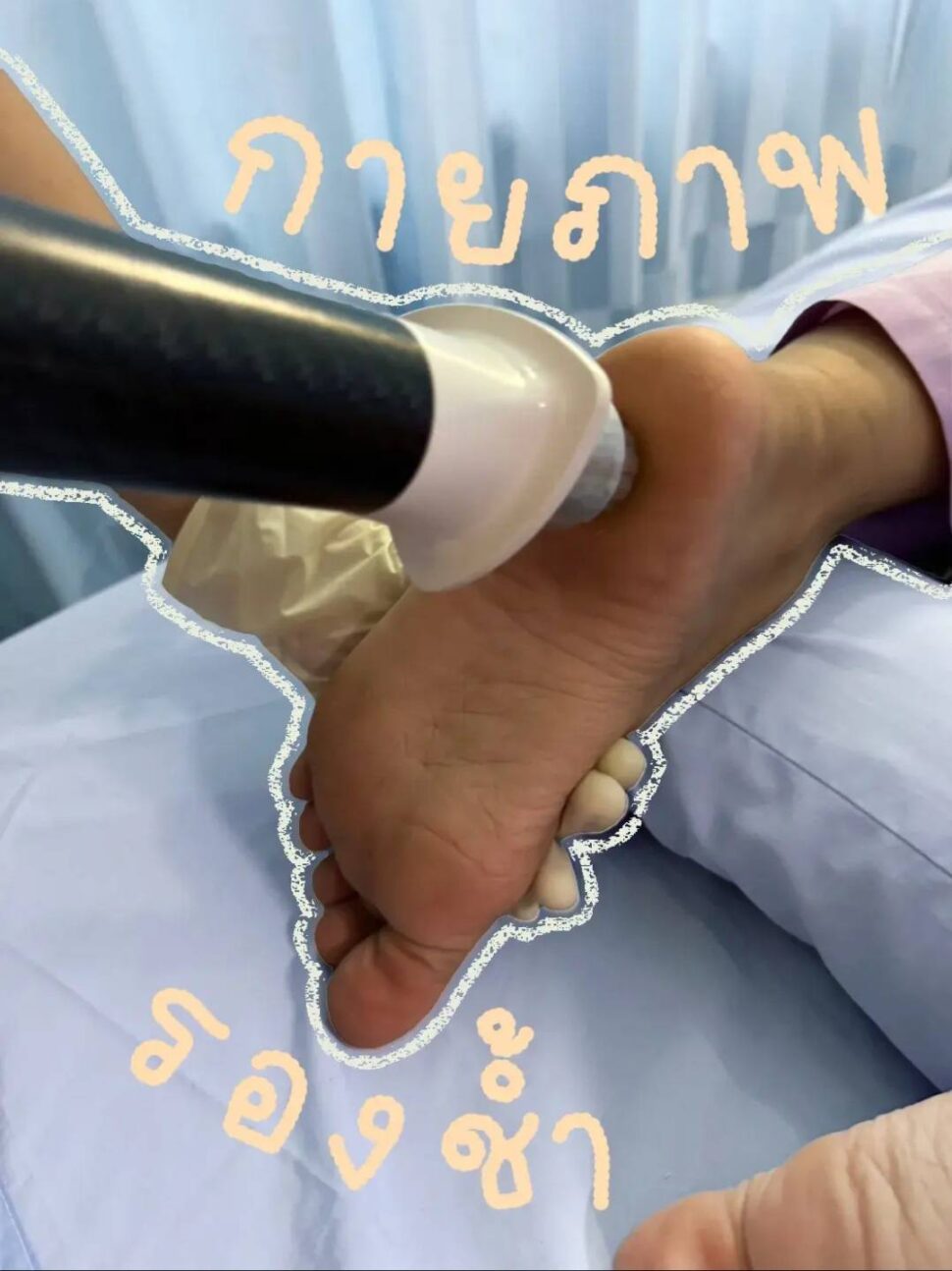 ตอนที่ 779 กายภาพบำบัดรองช้ำ - Firstphysio Clinic #รองช้ำ #เจ็บส้นเท้า #เดินแล้วเจ็บ #น่องตึง ...